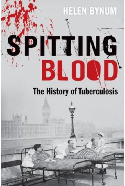 Spitting Blood The history of | Pegasas